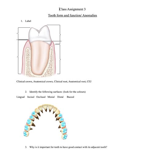 Solved Class Assignment 3tooth Form And Function