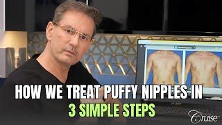 The Real Reason Behind Puffy Nipples And How To Fix Them Part 3 Dr Dc