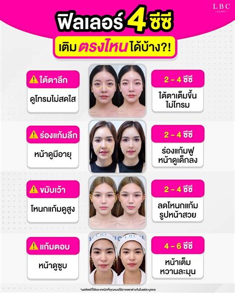 Lbc เลอบิวทิส แอลบีซี คลินิก