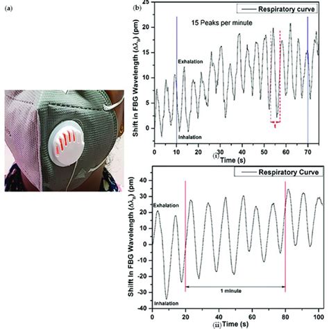 A Schematic Diagram Of Respirator For Respiratory Monitoring B Download Scientific Diagram