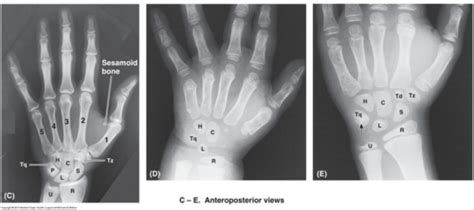 Osteology And Circulation Of Upper Limbs Flashcards Quizlet