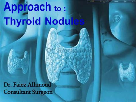 Approach To Thyroid Nodule Pptx