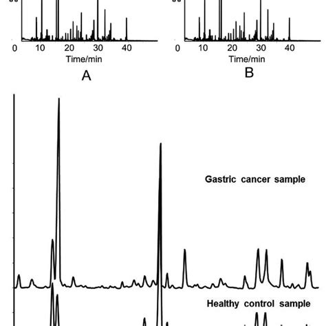 tic chromatograms of urine samples from different groups by gc ms download scientific diagram