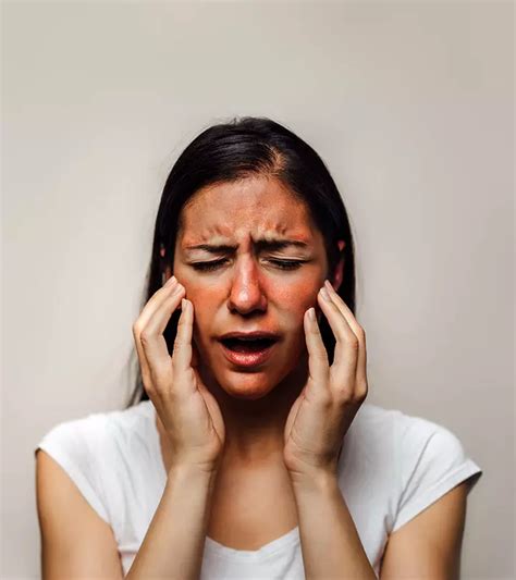 Sun Rash 4 Causes Symptoms Treatments And Prevention