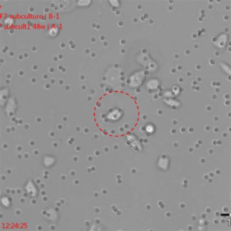 Single Cell Heterogeneity Analysis Sartorius