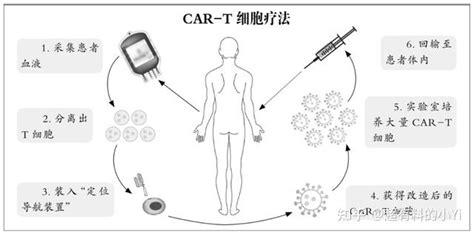 Car T细胞是什么？car T疗法又是什么？ 知乎