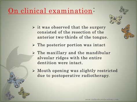 Partial Glossectomy Online Orthodontic Courses