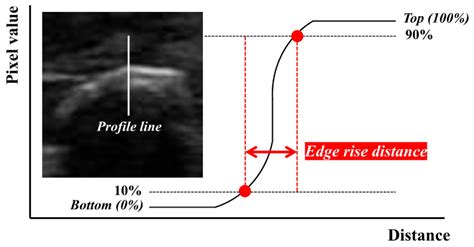 Performance Evaluation Of Ultrasound Images Using Non Local Means Algorithm With Adaptive