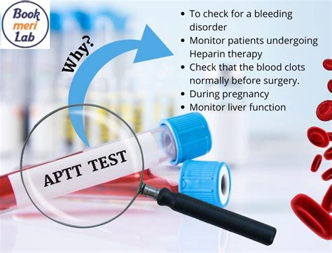 Aptt Test Price Purpose Procedure And Results 2022