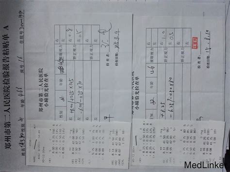 玻璃体切除治疗孔源性视网膜脱离 医联