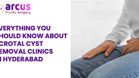 Everything You Should Know About Scrotal Cyst Removal Clinics In Hyderabad