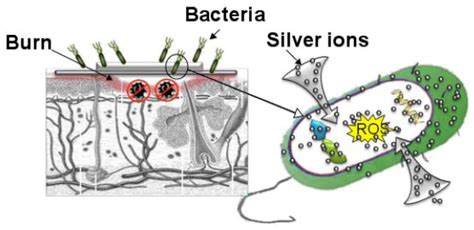 Use Of Silver As A Topical Antimicrobial Agent In Burns Download