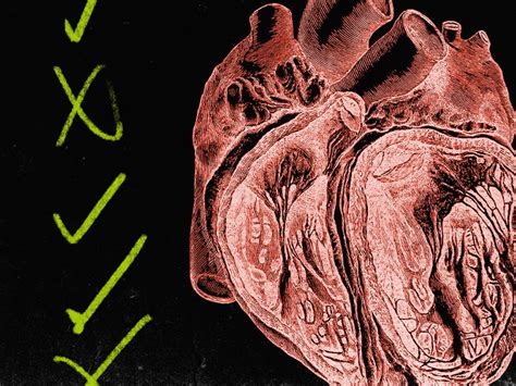 Heart Score What To Know