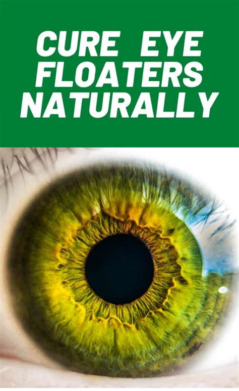 Eye Floaters Possible Causes Treatment And Home Remedies Healthy