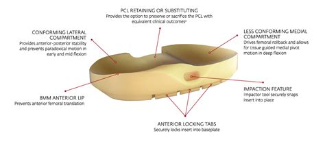 Empowr 3d Knee® Enovis