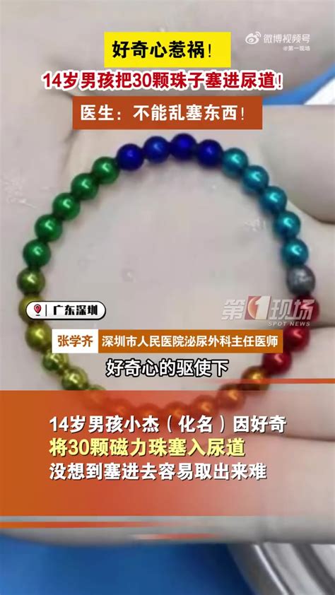 惊哭痛14岁男孩将30颗珠子塞进尿道 医生别塞了会出大问题的广东深圳14岁男孩小杰化名因好奇在洗澡时将30颗磁力珠塞