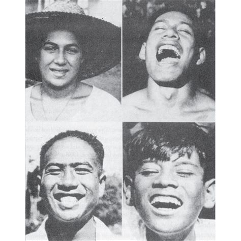 За здрави кости и зъби яжте природни храни