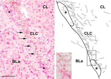 Photomicrograph Left Panel And Camera Lucida Drawing Right Panel Of