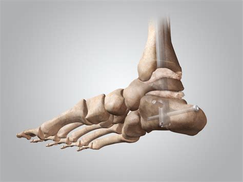 Orthopedic Solutions - Orthofix