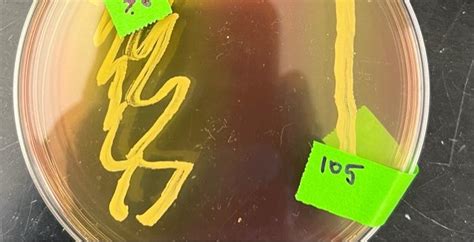 Solved Using Only The Info Below Is My Bacteria Staph