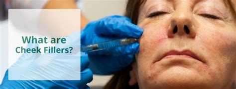 Cheek Fillers What Are They Cheek Bone Enhancement