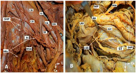 Inferior Mesenteric Plexus Superior Hypogastric Plexus And