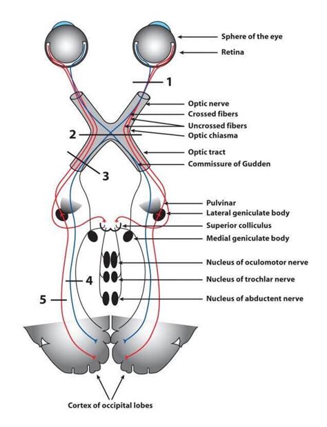 Optic Tract Lesions 1 Medical Exam Prep