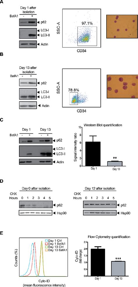 Figure 1 From Autophagy In Normal Hematopoiesis And Leukemia Semantic Scholar