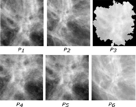 Figure 3 From Breast Mass Classification In Mammograms Using Ensemble Convolutional Neural