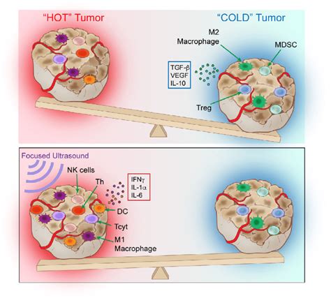 The Balance Between Intra Tumoral Immunosuppressive Cold And An Download Scientific Diagram