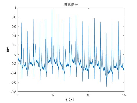 Matlab读取mit心电信号mit Bih库中心电信号 Csdn博客