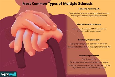 What Is The Plural Of Multiple Sclerosis At Stephanie Le Blog