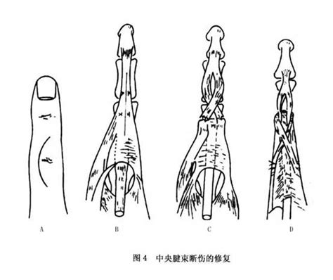 手指筋图片 手指筋的位置图 手筋图片 大山谷图库