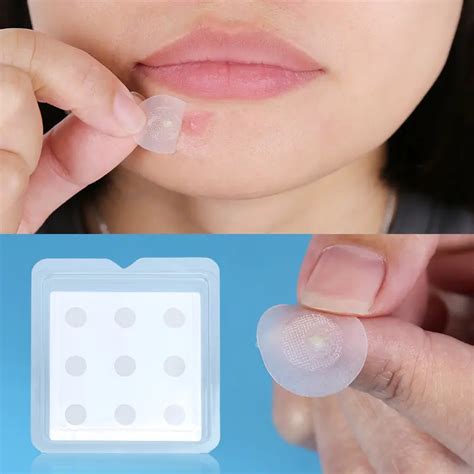 Calla Microneedle Pimple Patch Wholesale Manufacturer