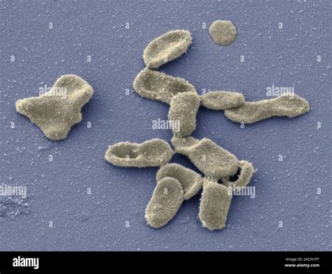 Mycoplasma Genitalium Coloured Scanning Electron Micrograph Sem Of A