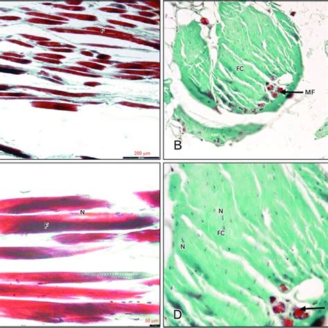 The Photomicrographs Of Longi­ Tudinally Sectioned Lumbrical Muscles