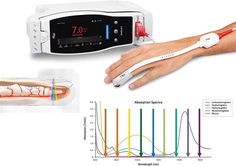 Noninvasive Monitoring Clinical Tree