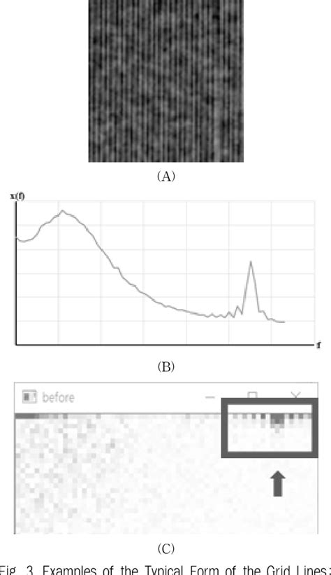 Figure 3 From A Dynamically Segmented Dct Technique For Grid Artifact Suppression In X Ray