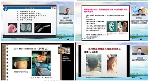 耳鼻咽喉 头颈外科推出先天性小耳畸形全链条防控服务包 湖南省儿童医院