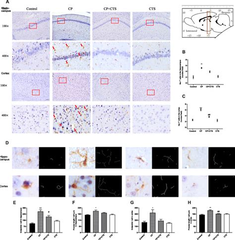 Activated Stat3 Signaling Pathway By Ligature Induced Periodontitis