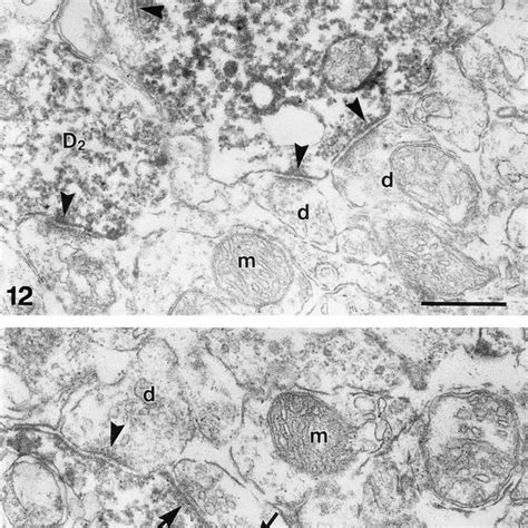 Synaptic Junctions Arrowheads Point To Postsynaptic Densities