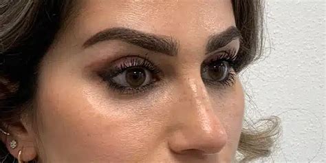 De Iris In Onze Ogen Looks Clinics