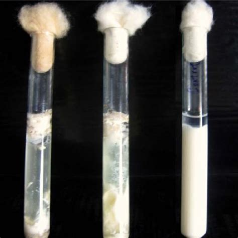 Milk Medium Showing The Classical Stormy Clot Reaction Of C