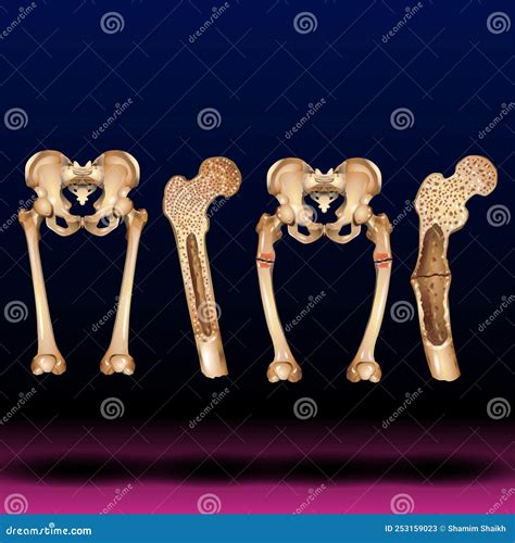 Structure Of The Pelvis Anatomical Poster Of Human Skeleton Stock