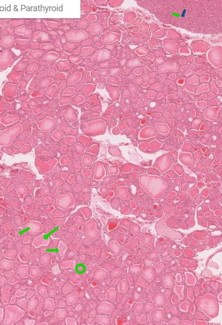Endocrine Histology Diagram Quizlet