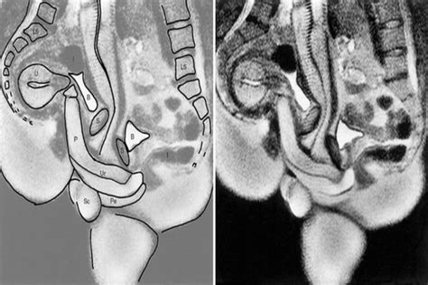 This Timeless Piece Of “body Art” Of People Having Sex In An Mri Turns
