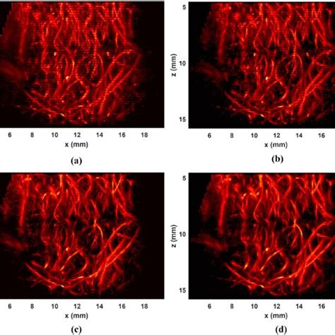Lateral Axial Projection Image Using A Motion Correction And