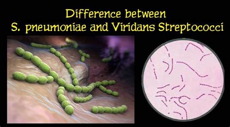 Streptococcus Viridans Aerococcus Viridans