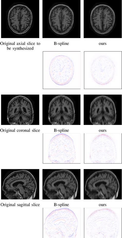 Autoencoding Low Resolution Mri For Semantically Smooth Interpolation