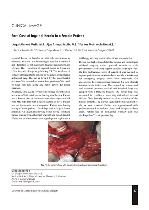 Pdf Rare Case Of Inguinal Hernia In A Female Patient Parvez Dar
